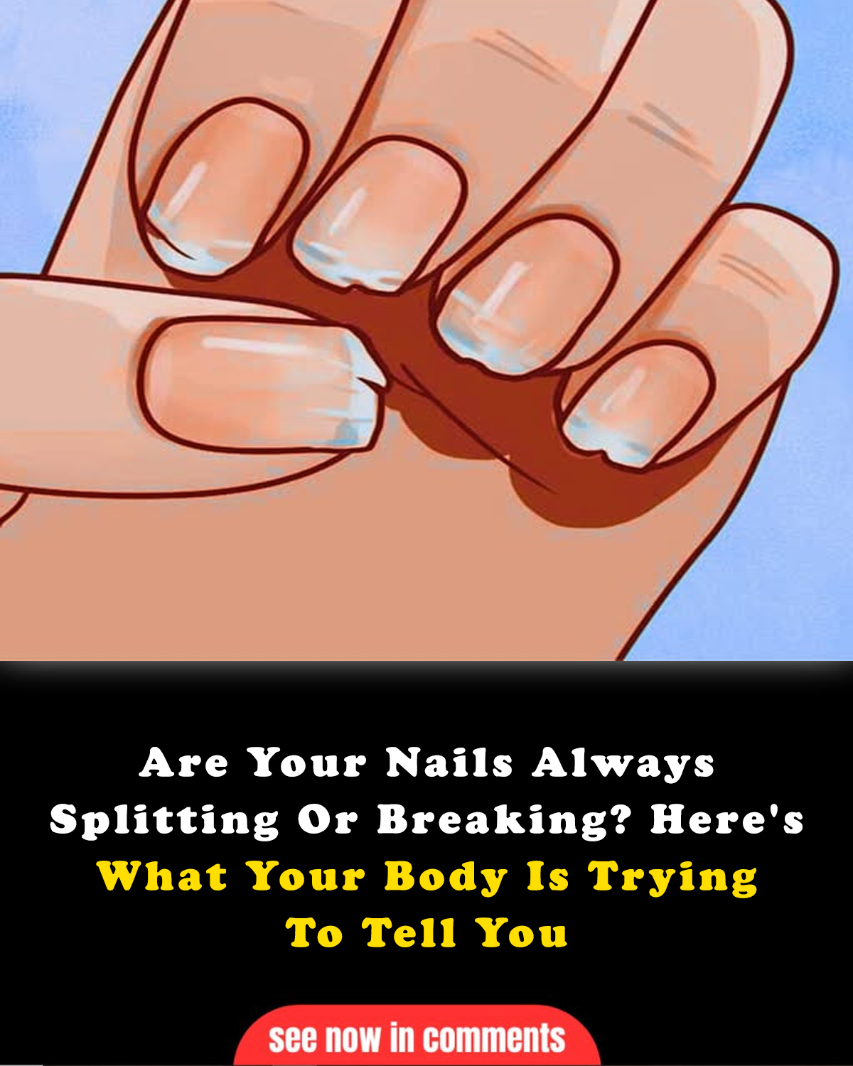 Are Your Nails Always Splitting Or Breaking? Here’s What Your Body Is ...