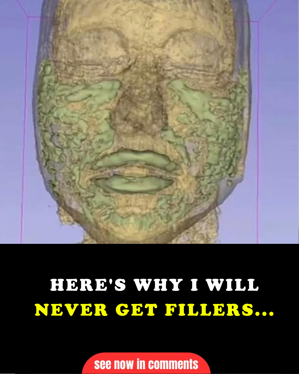 Doctor Reveals: MRI Scan Of The Face Of A 33-Year-Old Woman Reveals ...