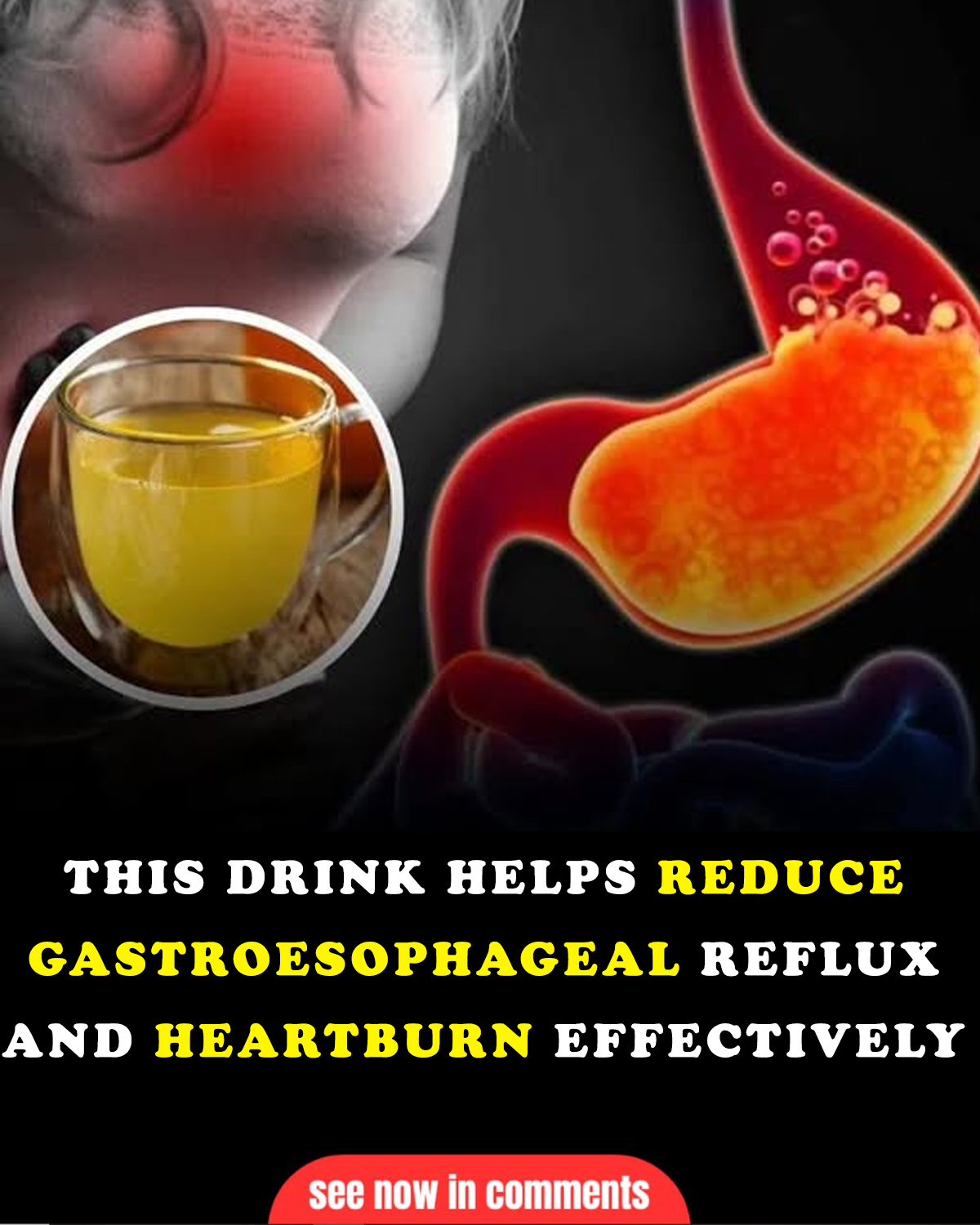 This drink helps reduce gastroesophageal reflux and heartburn effectively